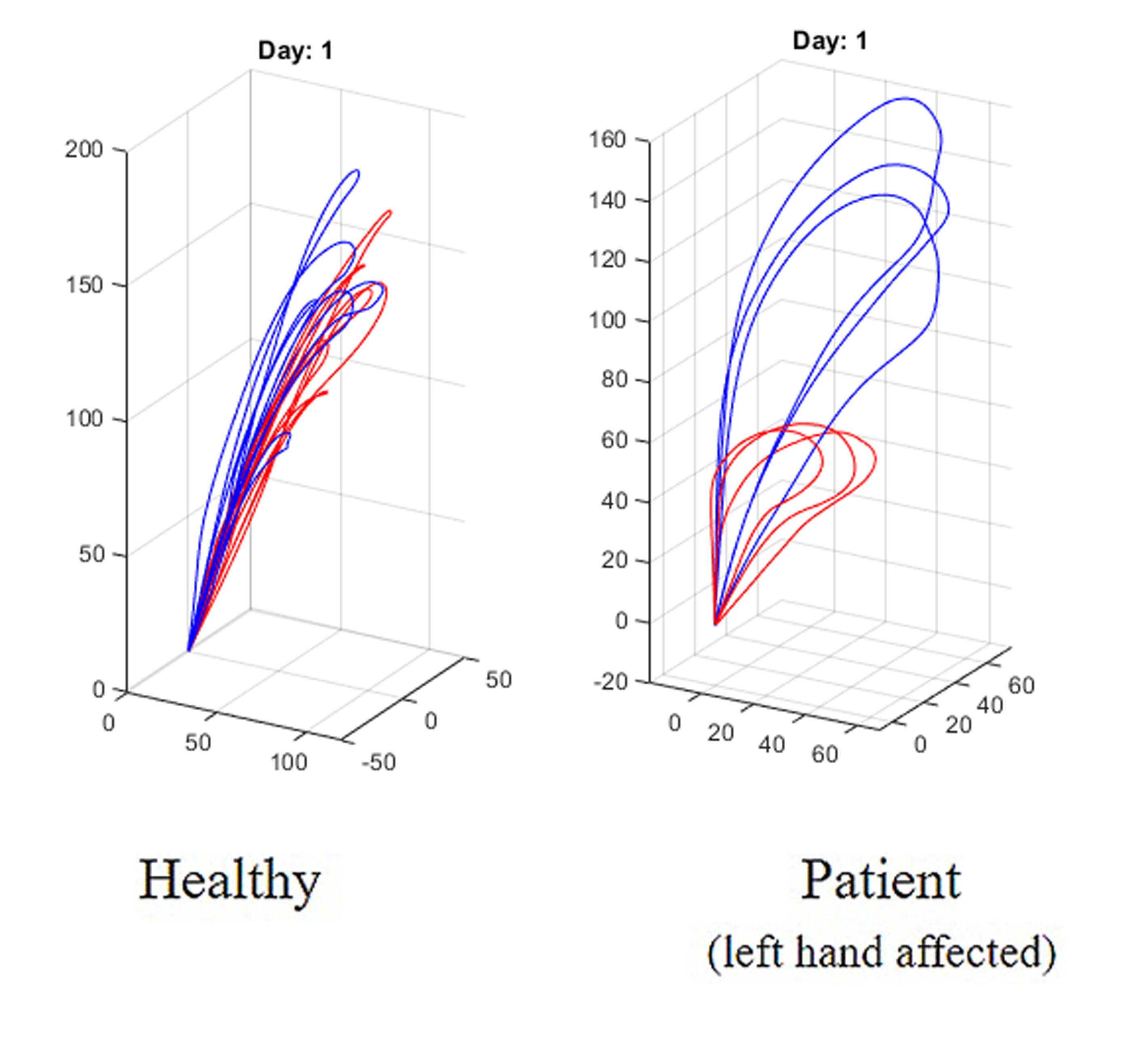 [2212.05063] The RPM3D project: 3D Kinematics for Remote Patient ...