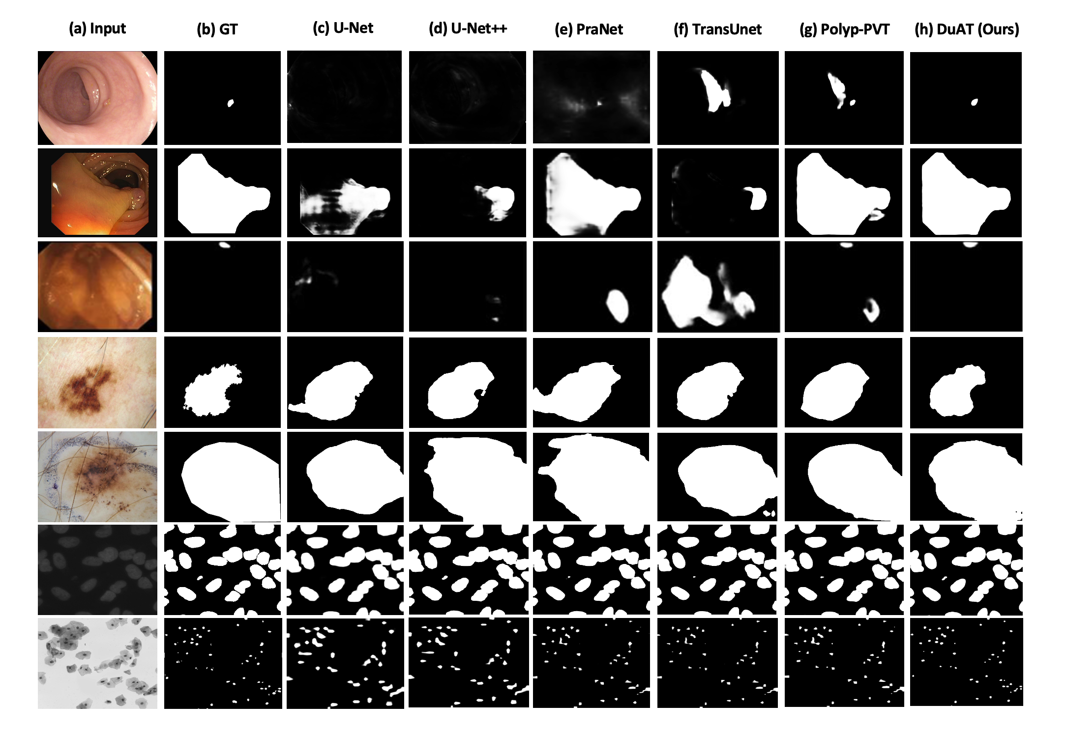 [2212.11677] DuAT: Dual-Aggregation Transformer Network for Medical ...