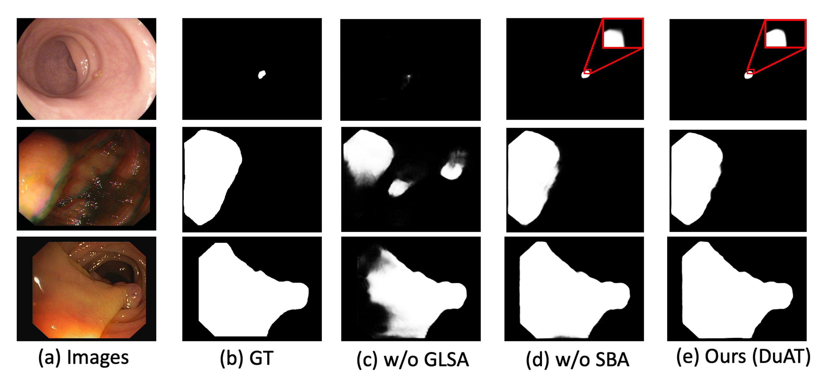 [2212.11677] DuAT: Dual-Aggregation Transformer Network for Medical ...