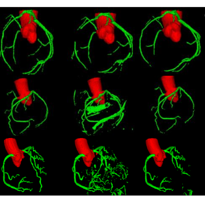 [2301.02393] Graph Convolution Based Cross-Network Multi-Scale Feature Fusion for Deep Vessel ...