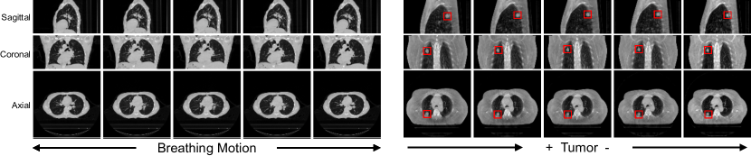 [2301.05465] Explicit Temporal Embedding in Deep Generative Latent Models for Longitudinal ...
