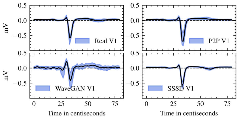 [2301.08227] Diffusion-based Conditional ECG Generation with Structured State Space Models
