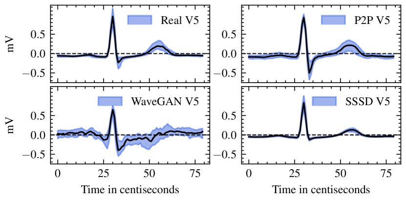 [2301.08227] Diffusion-based Conditional ECG Generation with Structured State Space Models