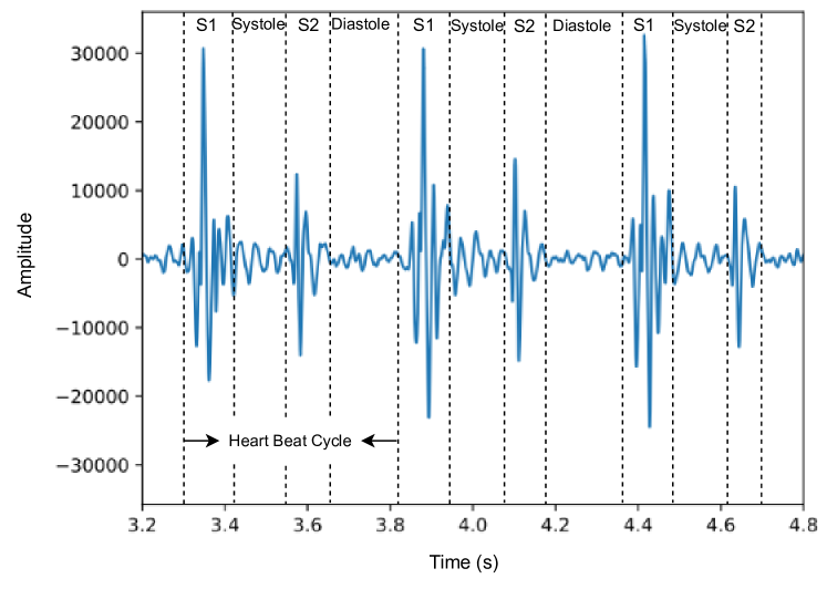 [2301.09362] A Comprehensive Survey on Heart Sound Analysis in the Deep ...