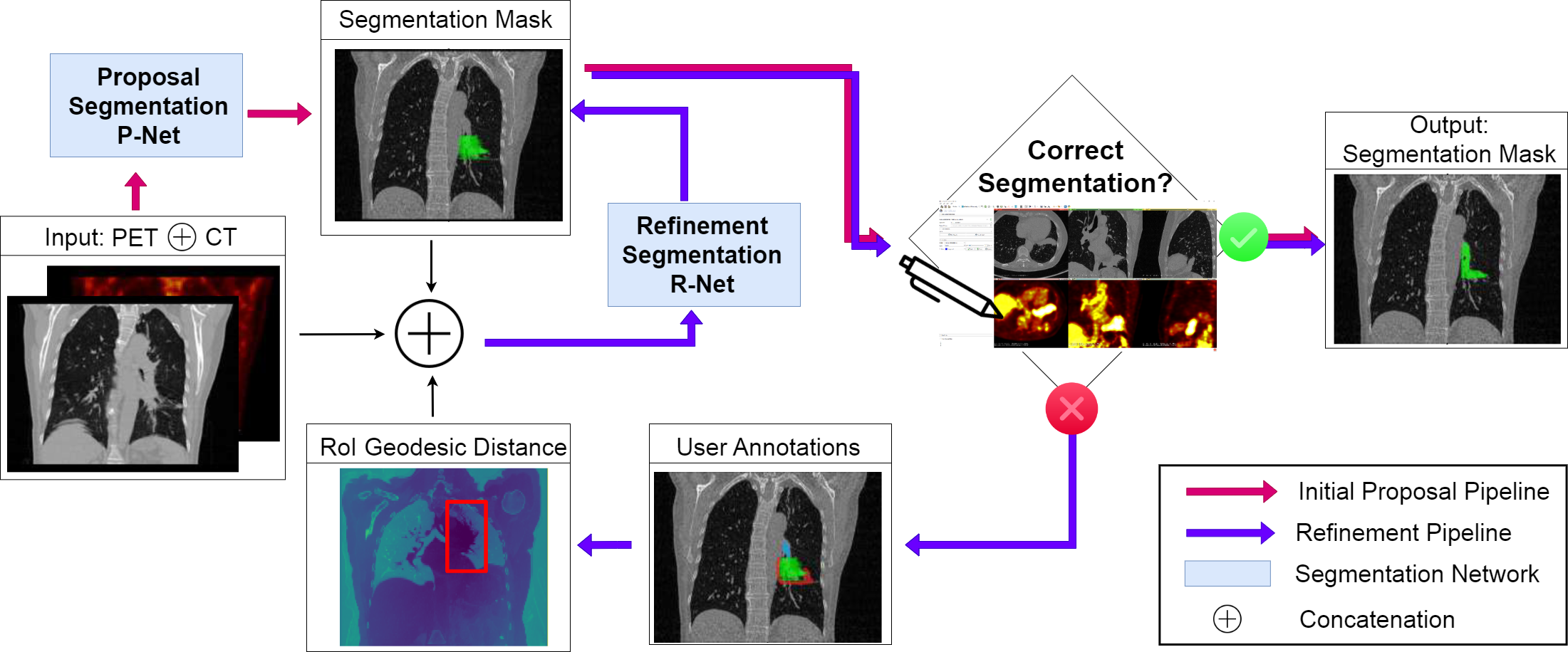 [2301.09914] Multimodal Interactive Lung Lesion Segmentation: A Framework For Annotating PET/CT ...