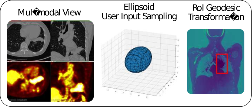 [2301.09914] Multimodal Interactive Lung Lesion Segmentation: A Framework For Annotating PET/CT ...