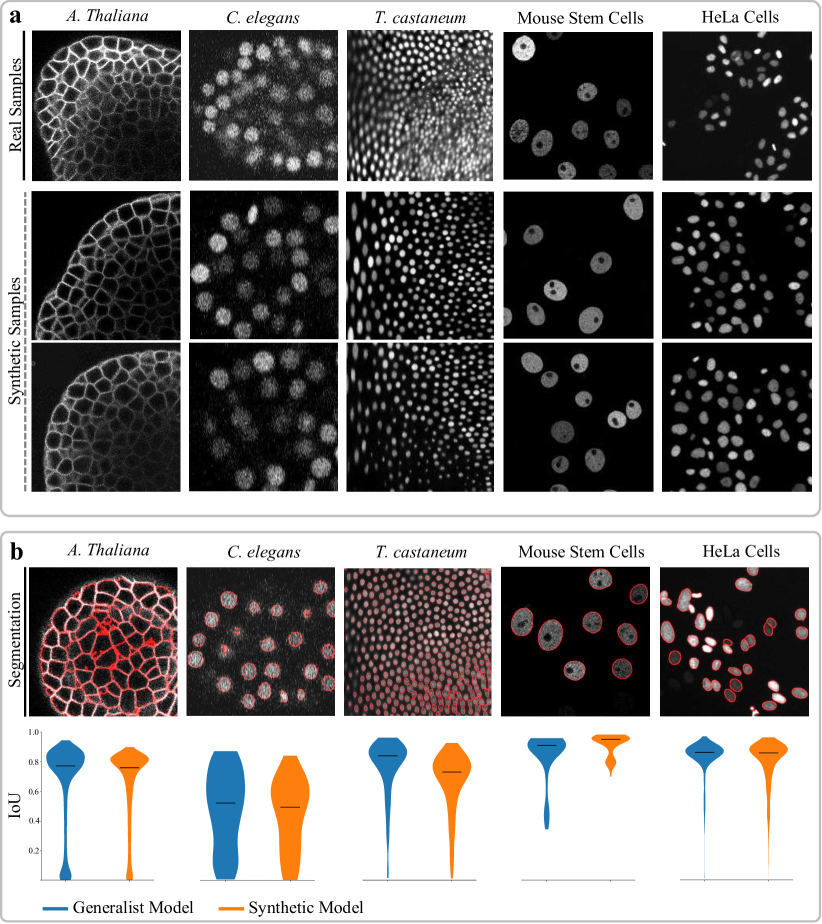 [2301.10227] Denoising Diffusion Probabilistic Models for Generation of ...