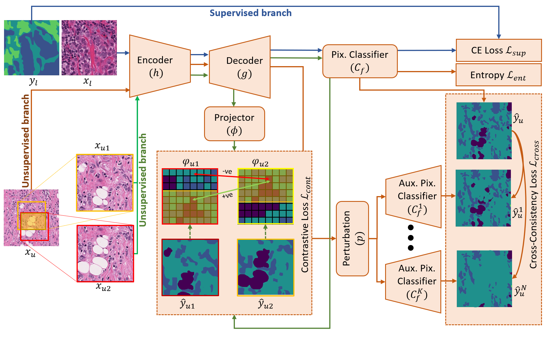 [2301.13141] Consistency Regularisation in Varying Contexts and Feature Perturbations for Semi ...