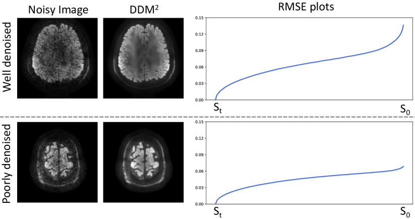 [2302.03018] DDM2: Self-Supervised Diffusion MRI Denoising with Generative Diffusion Models