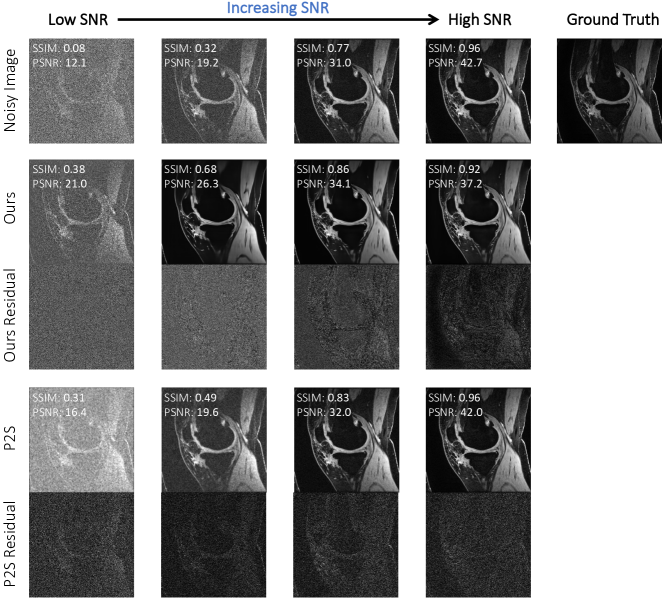 [2302.03018] DDM2: Self-Supervised Diffusion MRI Denoising with Generative Diffusion Models
