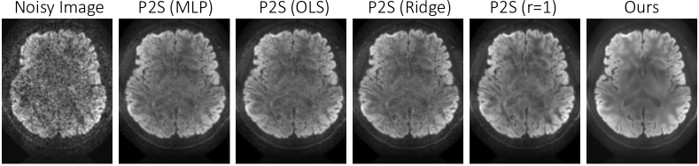 [2302.03018] DDM2: Self-Supervised Diffusion MRI Denoising with Generative Diffusion Models