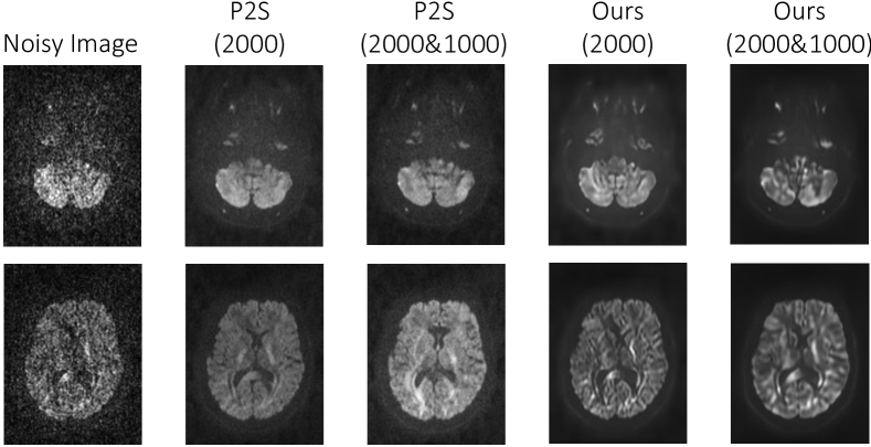[2302.03018] DDM2: Self-Supervised Diffusion MRI Denoising with Generative Diffusion Models