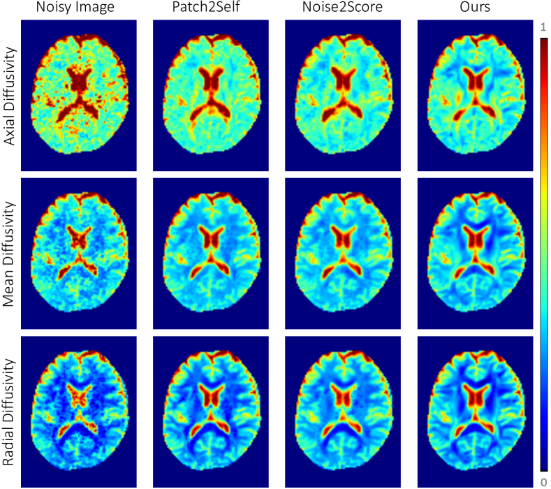 [2302.03018] DDM2: Self-Supervised Diffusion MRI Denoising with Generative Diffusion Models