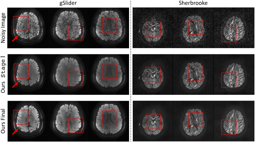 [2302.03018] DDM2: Self-Supervised Diffusion MRI Denoising with Generative Diffusion Models
