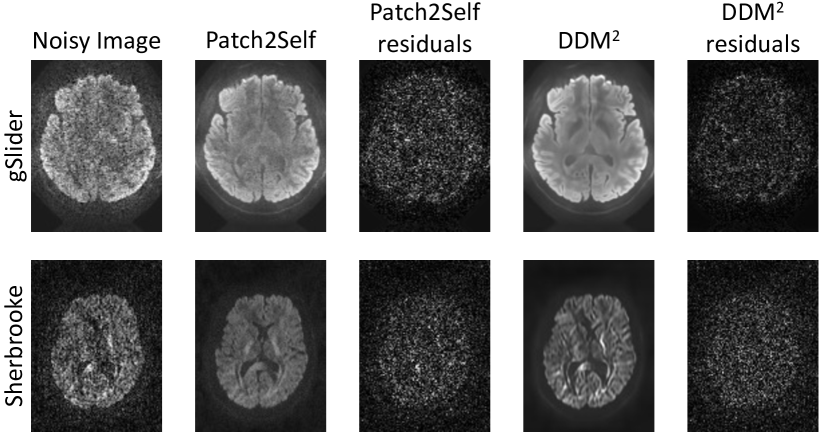 [2302.03018] DDM2: Self-Supervised Diffusion MRI Denoising with Generative Diffusion Models
