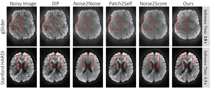 [2302.03018] DDM2: Self-Supervised Diffusion MRI Denoising with ...