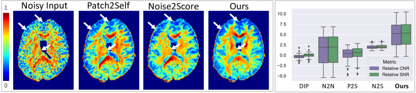 [2302.03018] DDM2: Self-Supervised Diffusion MRI Denoising with Generative Diffusion Models