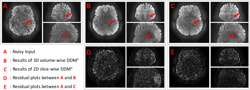 [2302.03018] DDM2: Self-Supervised Diffusion MRI Denoising with Generative Diffusion Models