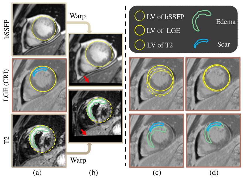 [2302.03537] Aligning Multi-Sequence CMR Towards Fully Automated Myocardial Pathology Segmentation