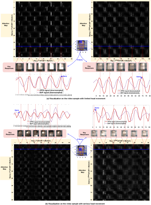 [2302 03548] Physformer Facial Video Based Physiological Measurement