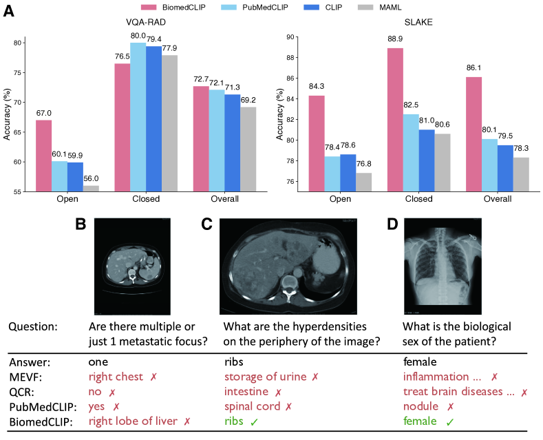 [2303.00915] BiomedCLIP: a multimodal biomedical foundation model ...