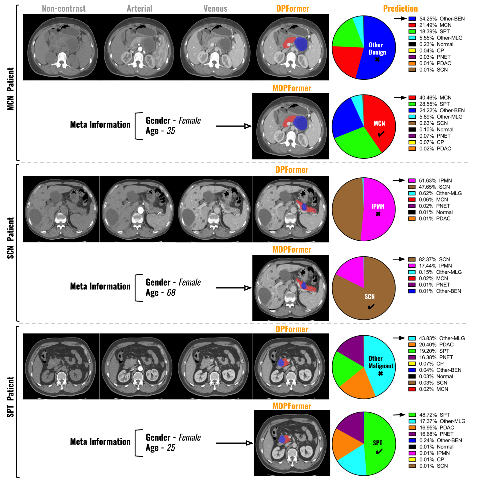[2303.00942] Meta-information-aware Dual-path Transformer for Differential Diagnosis of Multi ...