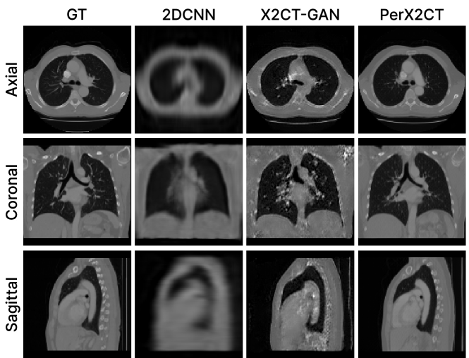 [2303.05297] Perspective Projection-Based 3D CT Reconstruction from ...