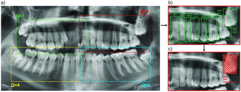[2303.06500] Diffusion-Based Hierarchical Multi-Label Object Detection to Analyze Panoramic ...