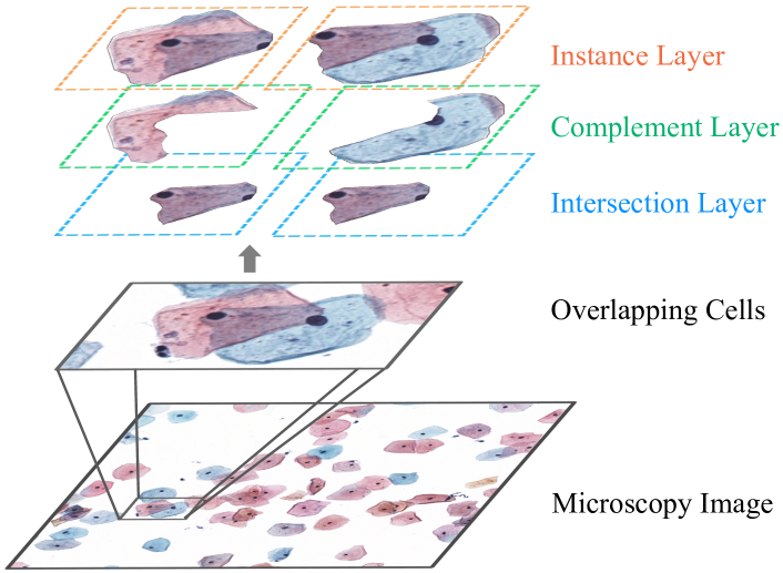 [2303.14373] DoNet: Deep De-overlapping Network for Cytology Instance Segmentation
