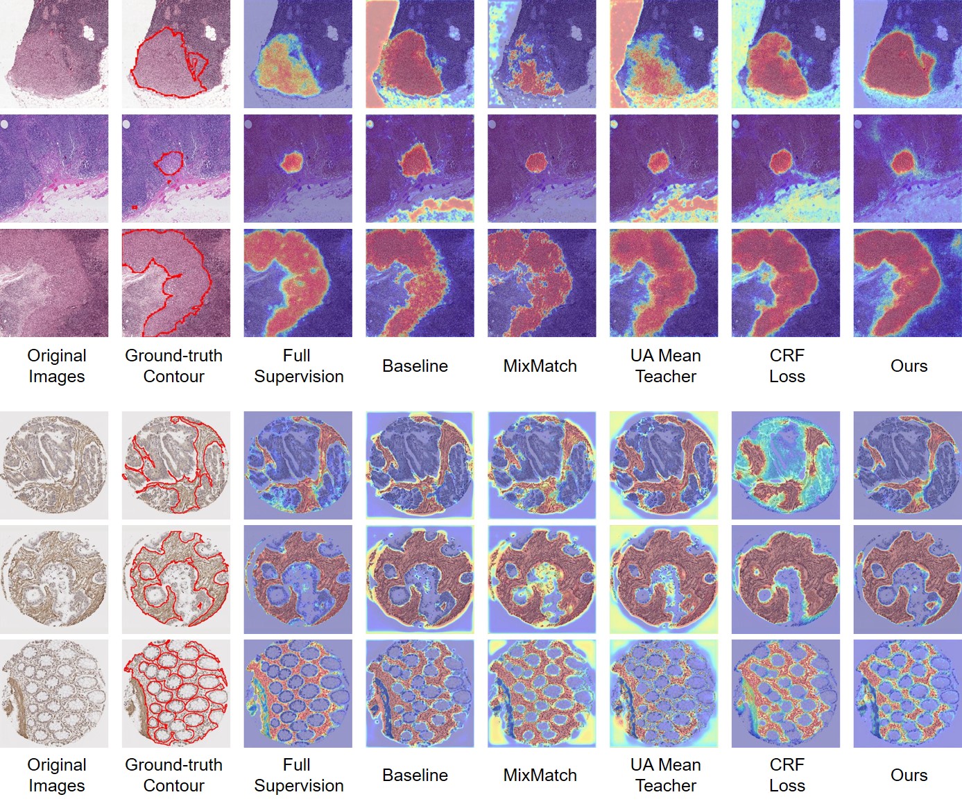 [2304.03572] Weakly supervised segmentation with point annotations for histopathology images via ...