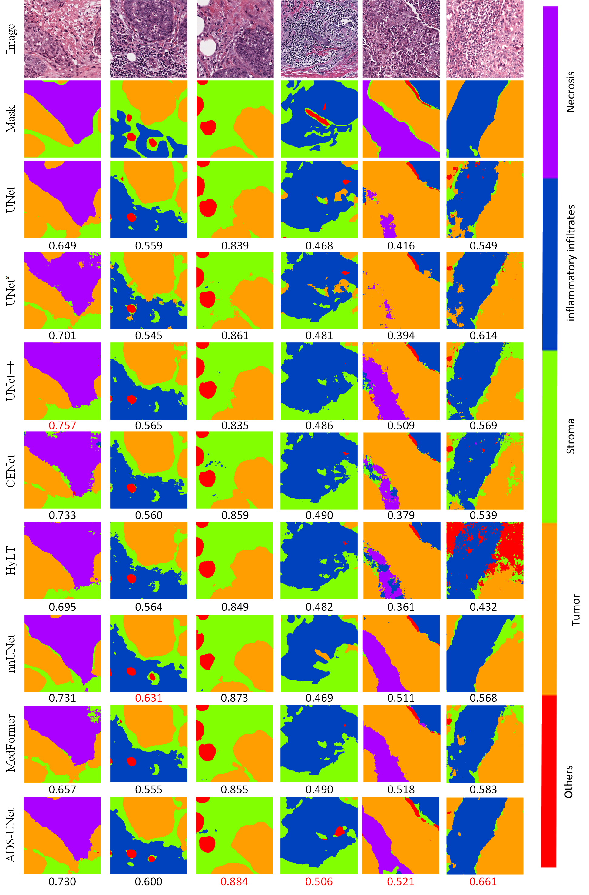 [2304.04567] ADS_UNet: A Nested UNet for Histopathology Image Segmentation