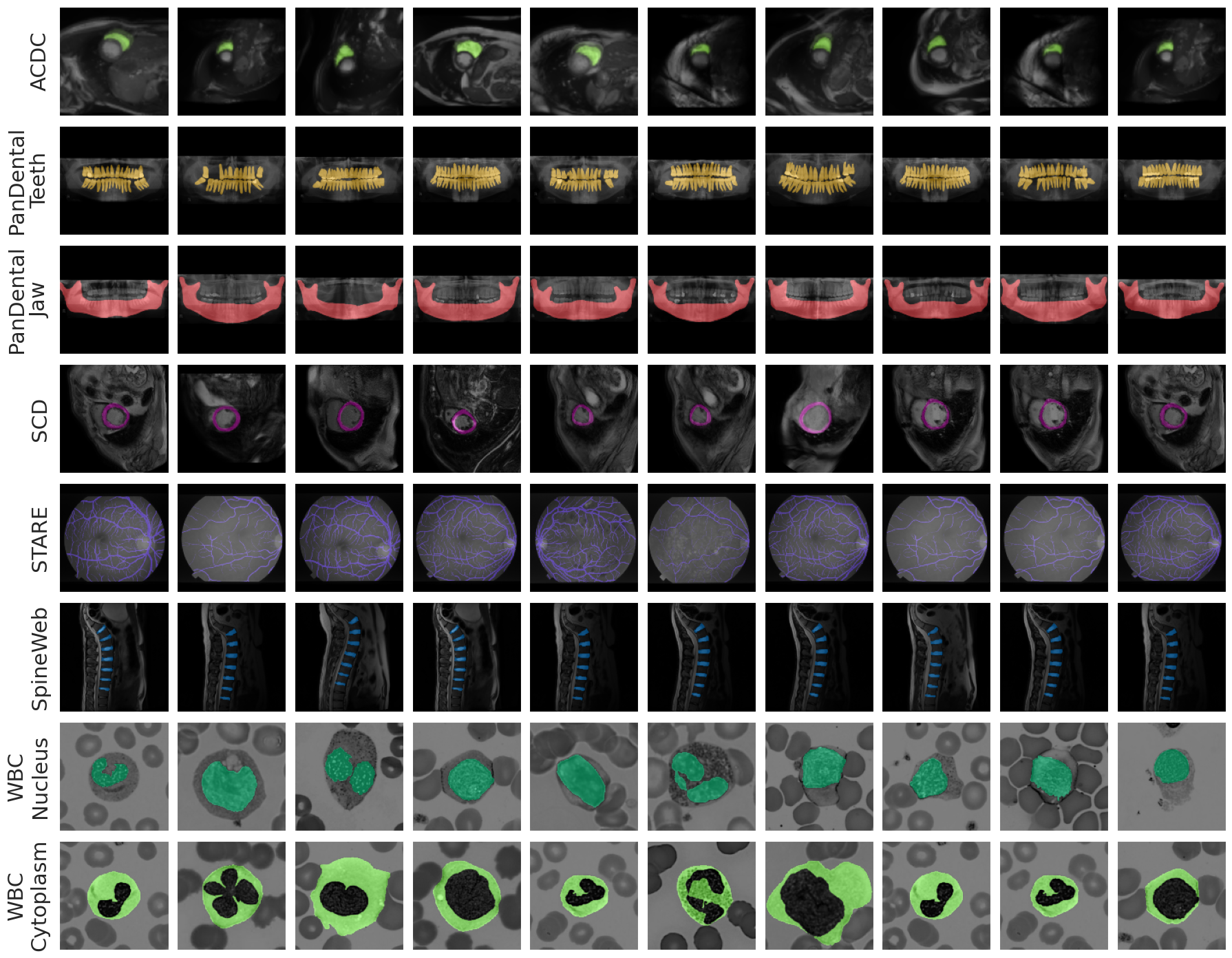 [2304.06131] UniverSeg: Universal Medical Image Segmentation