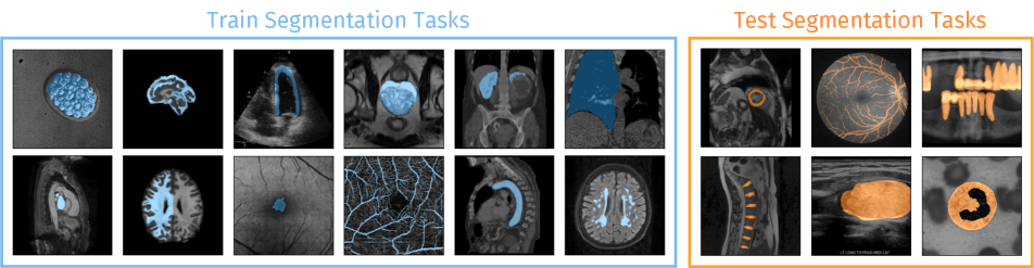 [2304.06131] UniverSeg: Universal Medical Image Segmentation