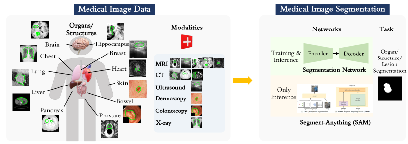 [2304.09324] Computer-Vision Benchmark Segment-Anything Model (SAM) in ...