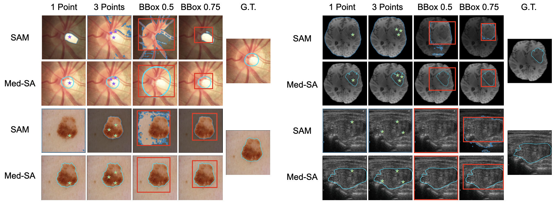 [2304.12620] Medical SAM Adapter: Adapting Segment Anything Model for ...