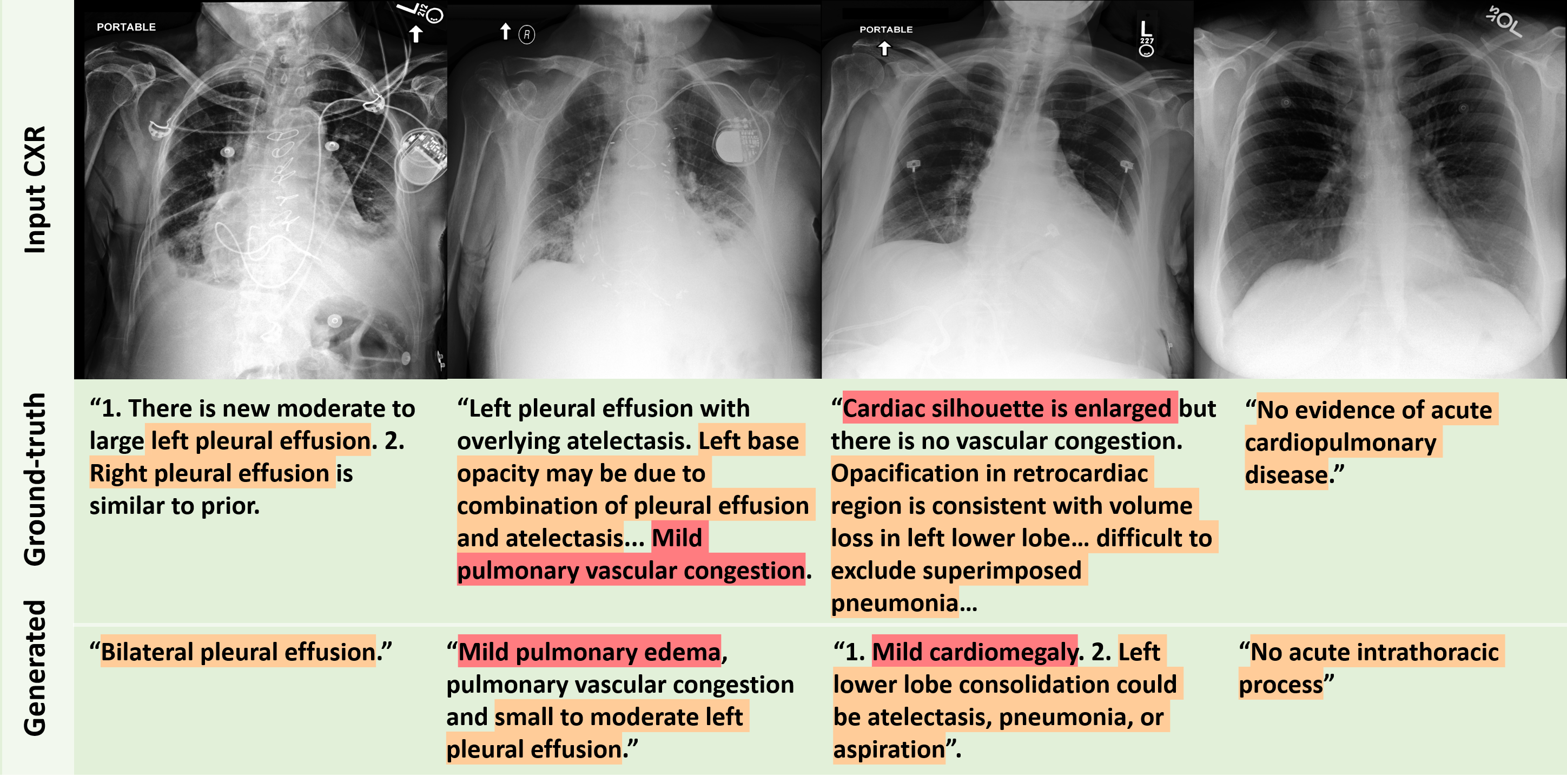 [2305.11490] LLM-CXR: Instruction-Finetuned LLM for CXR Image ...