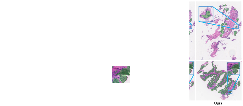 [2305.18830] Semi-supervised Pathological Image Segmentation via Cross Distillation of Multiple ...