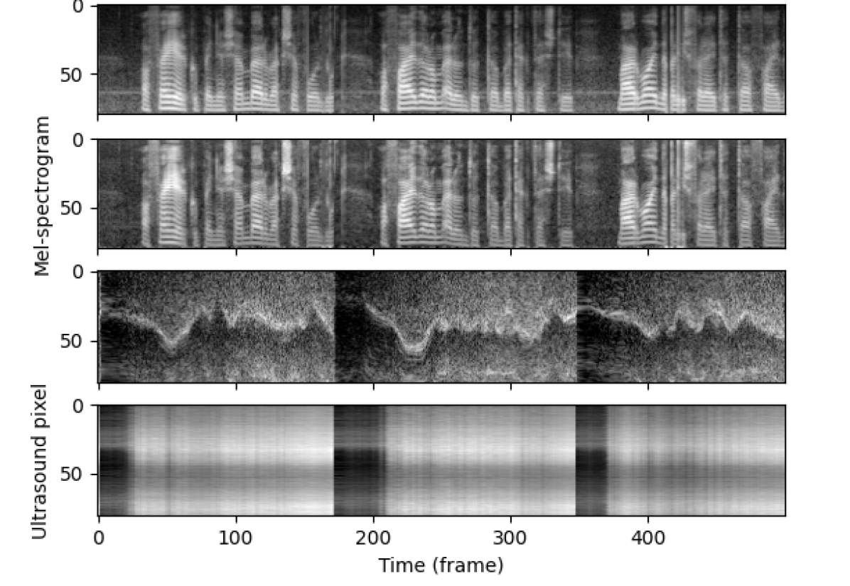 [2306.05374] Towards Ultrasound Tongue Image prediction from EEG during ...