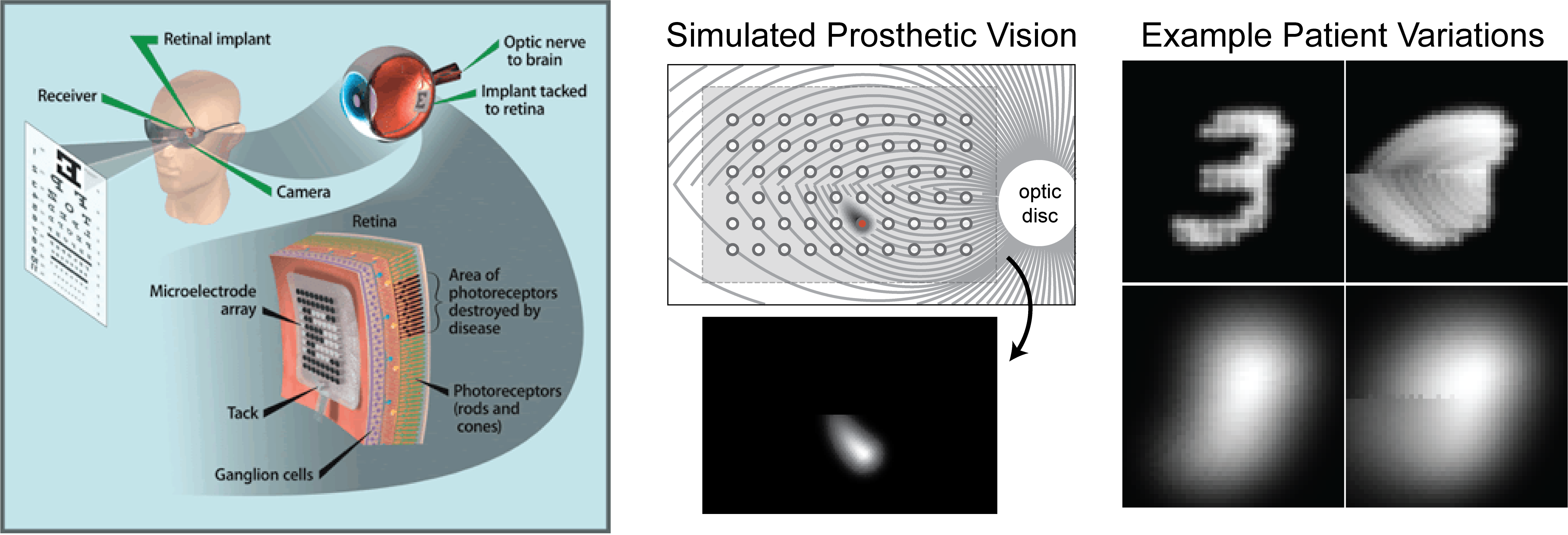 [2306.13104] Human-in-the-Loop Optimization for Deep Stimulus Encoding in Visual Prostheses