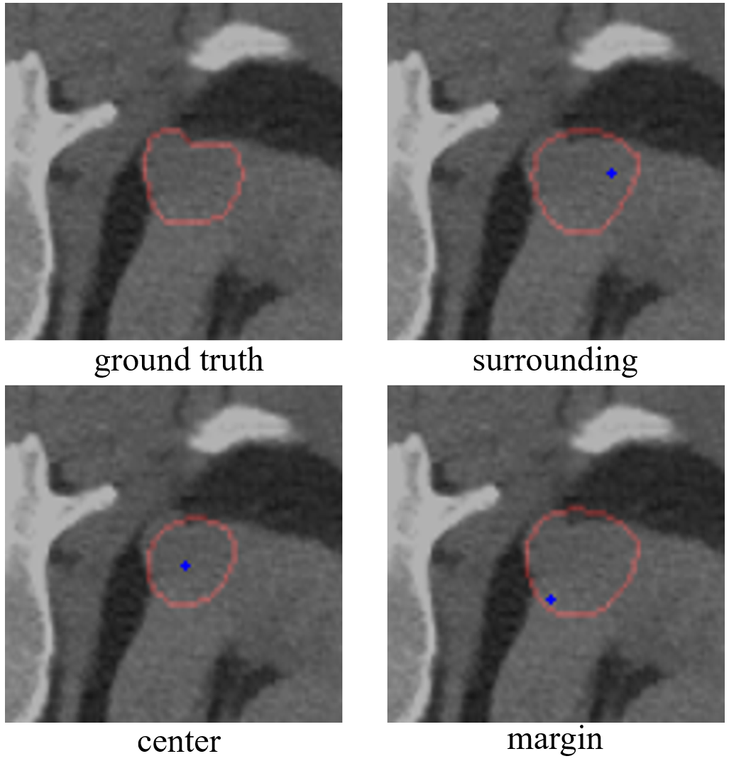 [2306.13465] 3DSAM-adapter: Holistic Adaptation of SAM from 2D to 3D ...