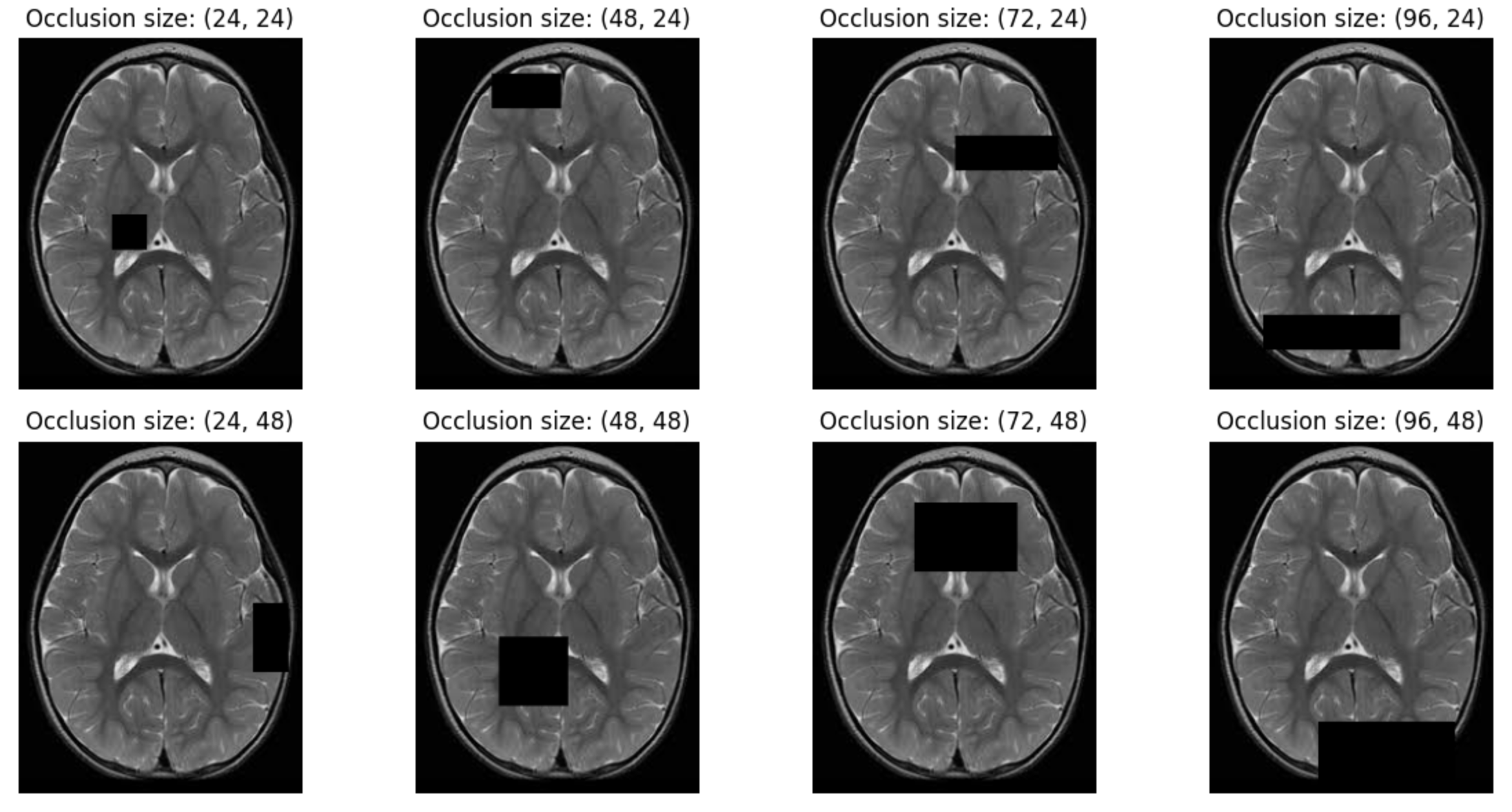 [2306.15574] See Through the Fog: Curriculum Learning with Progressive ...