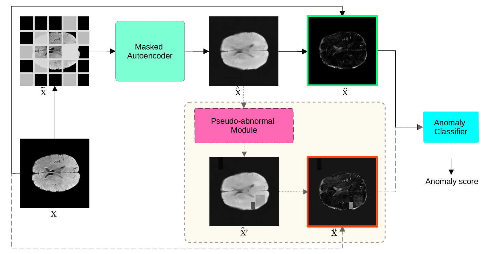 [2307.07534] Masked Autoencoders for Unsupervised Anomaly Detection in ...