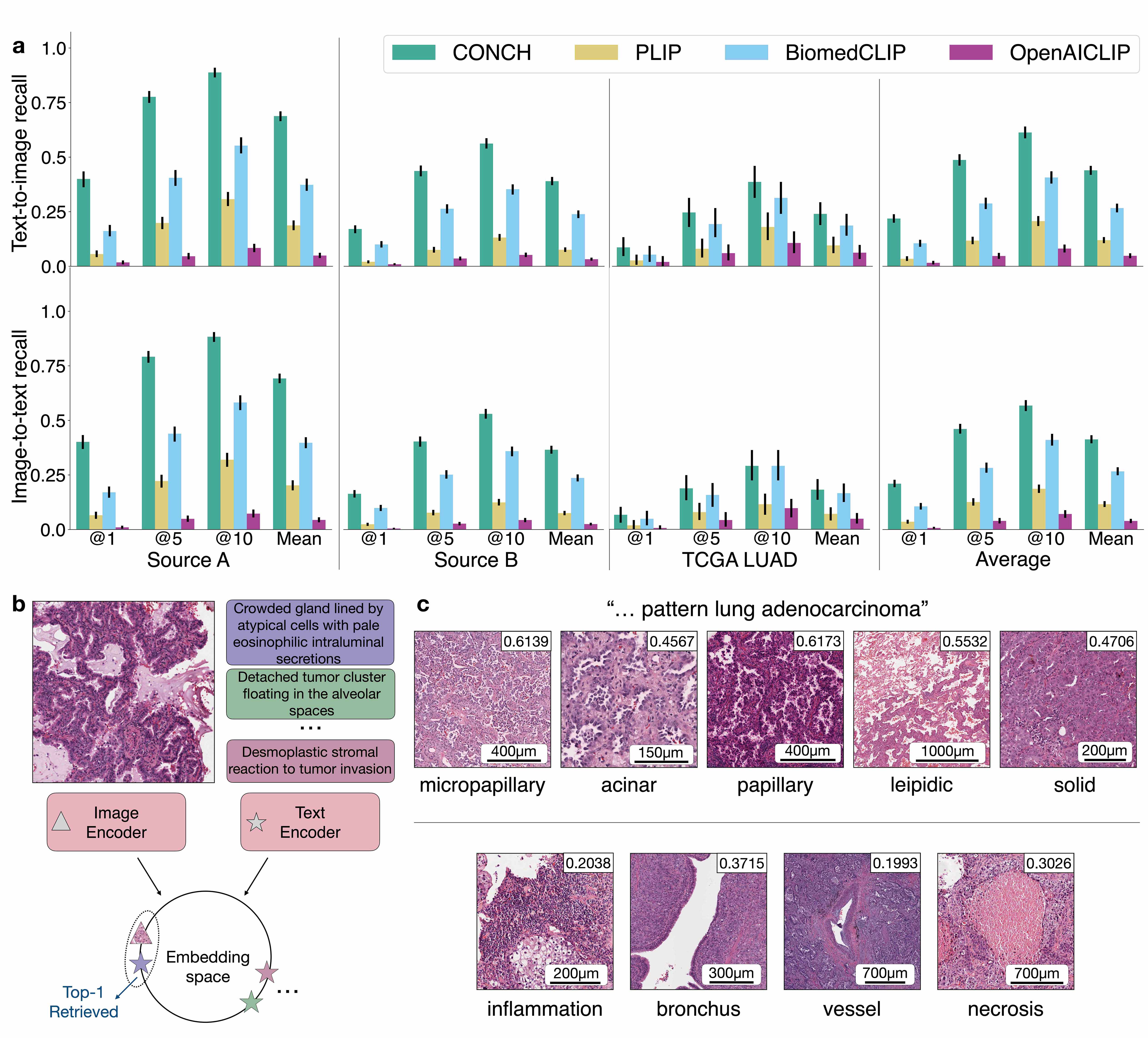[2307.12914] Towards a Visual-Language Foundation Model for Computational Pathology