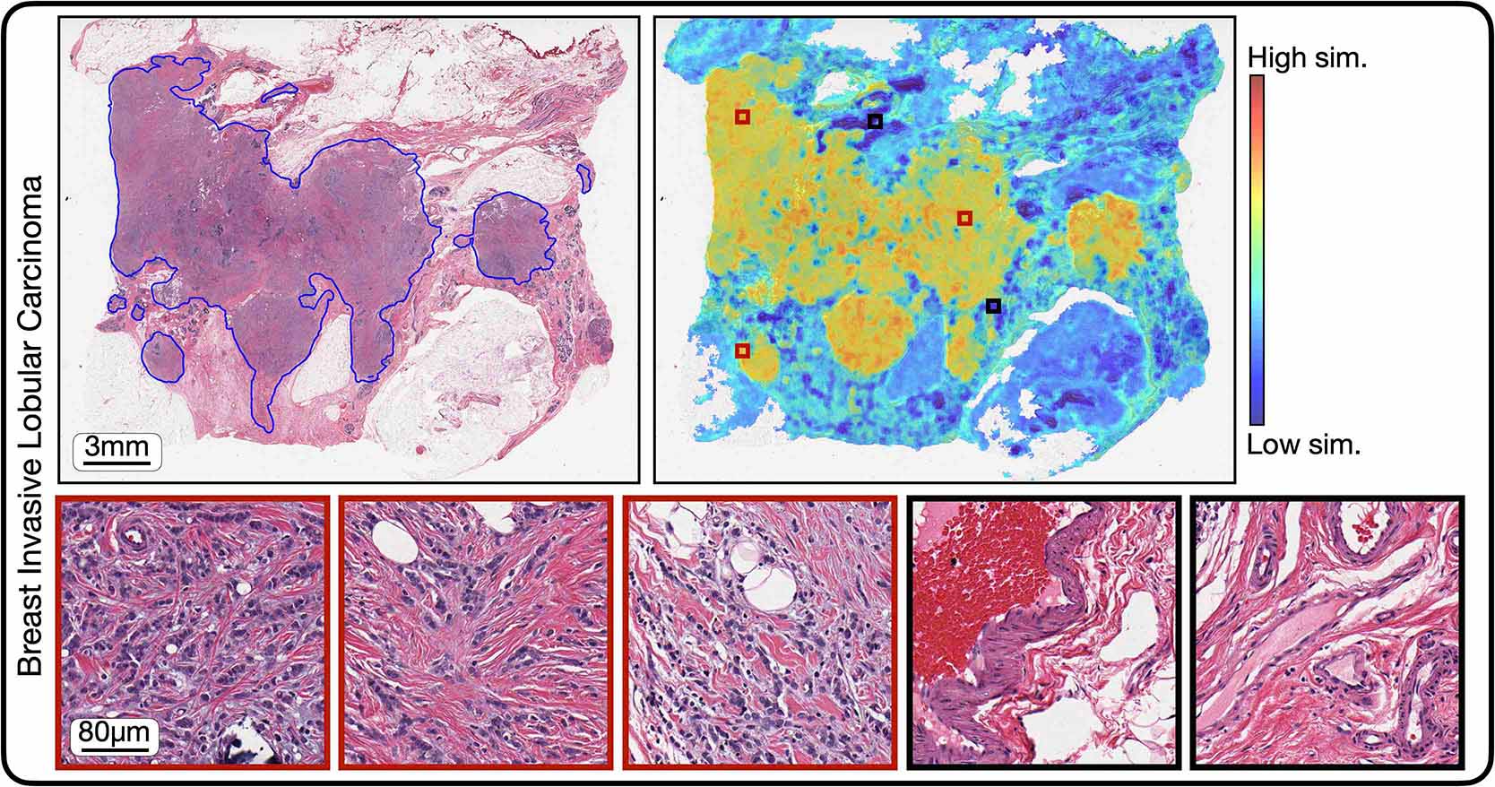 [2307.12914] Towards a Visual-Language Foundation Model for Computational Pathology