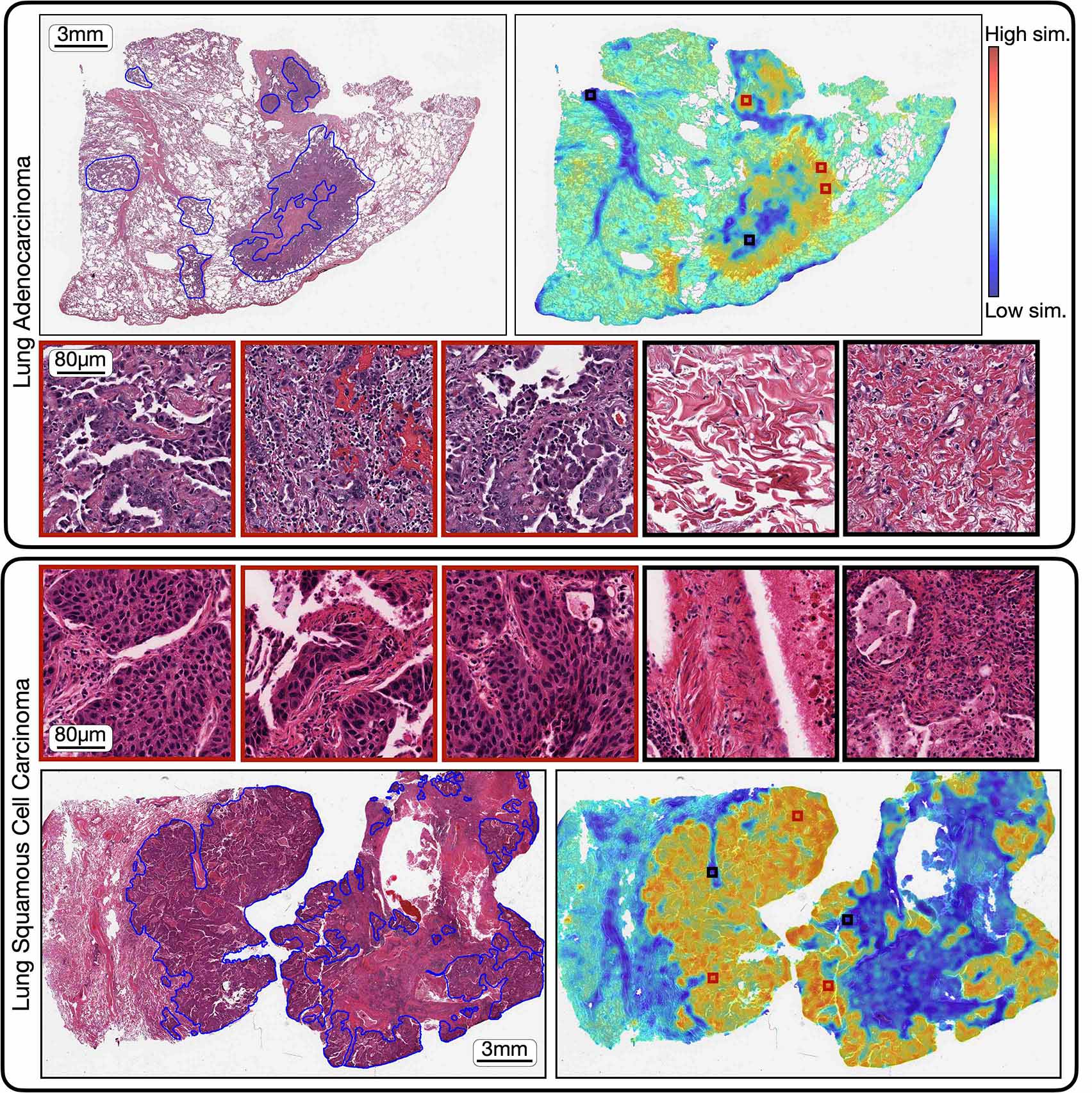 [2307.12914] Towards a Visual-Language Foundation Model for Computational Pathology