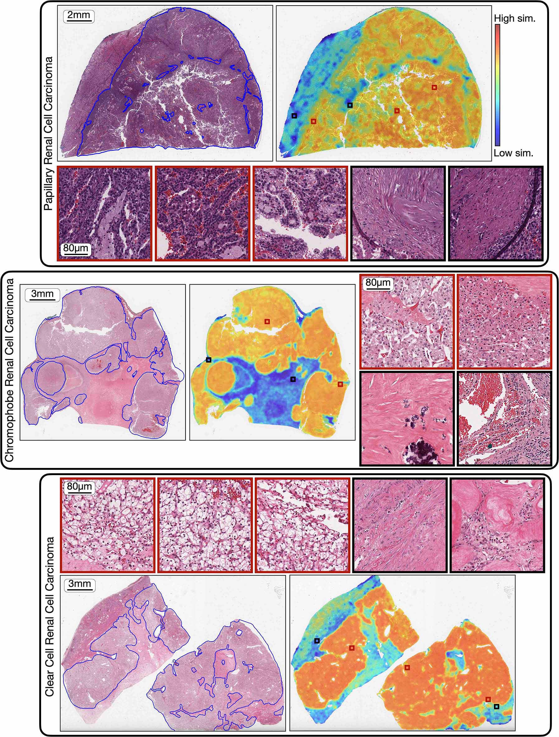 [2307.12914] Towards a Visual-Language Foundation Model for Computational Pathology