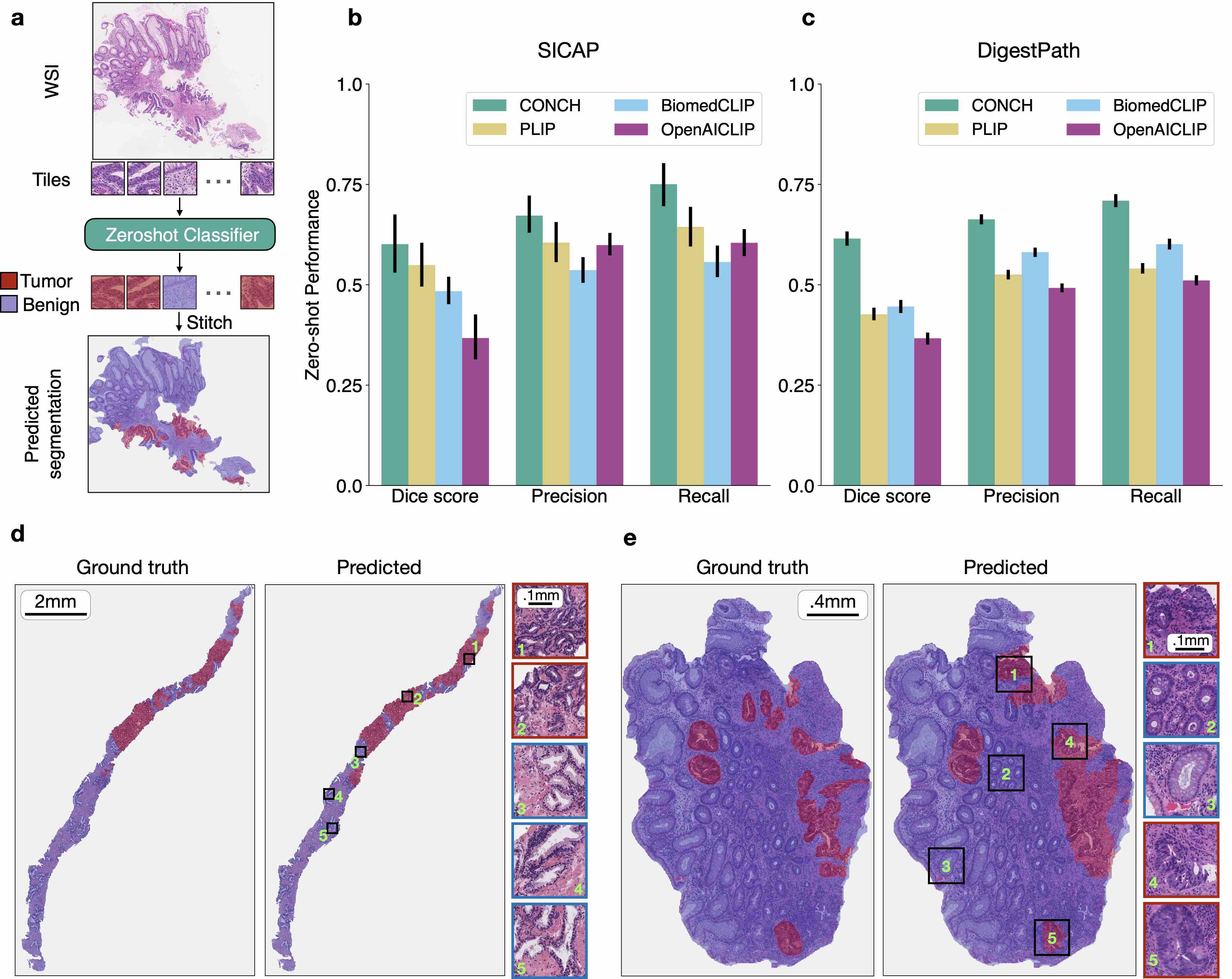 [2307.12914] Towards a Visual-Language Foundation Model for Computational Pathology