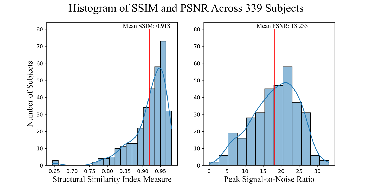 [2309.00569] Amyloid-Beta Axial Plane PET Synthesis from Structural MRI ...