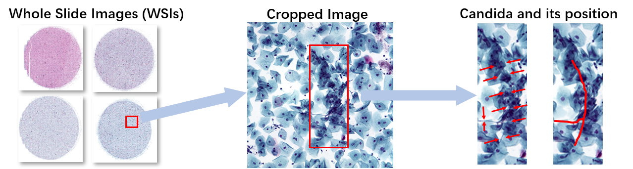 [2309.02670] Progressive Attention Guidance for Whole Slide ...