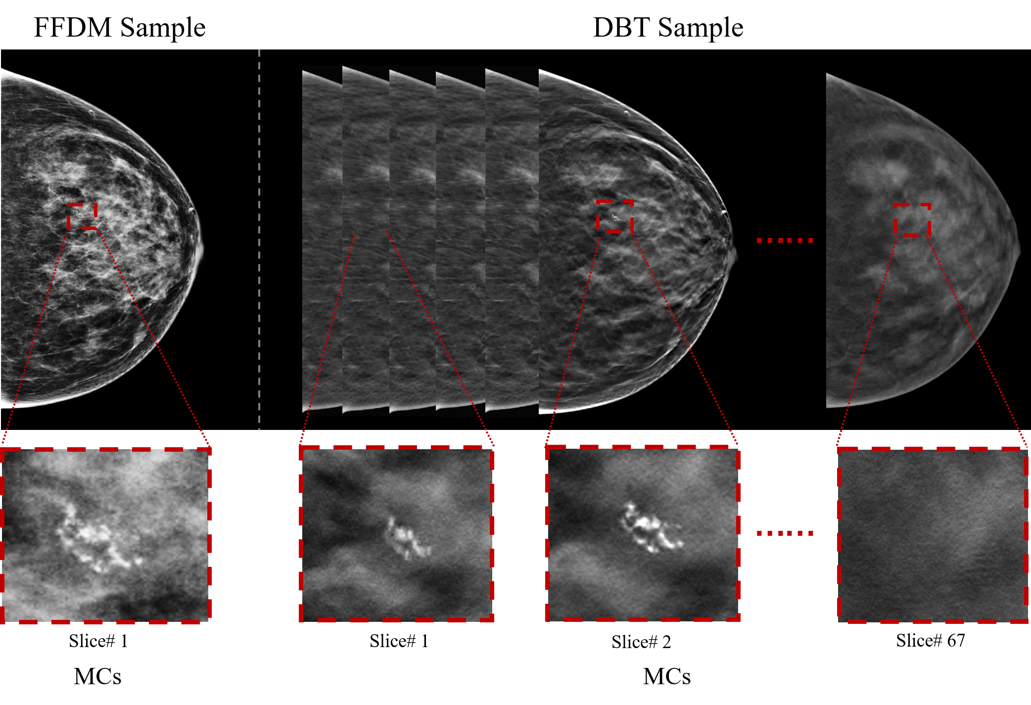 [2309.02742] MLN-net: A multi-source medical image segmentation method for clustered ...